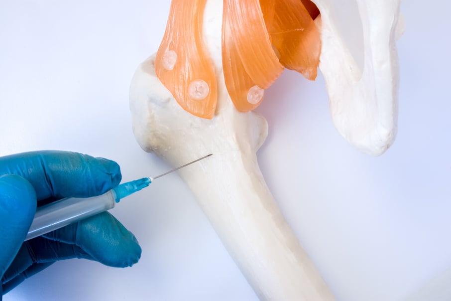 What to Expect from a Bone Marrow Biopsy: 5 Questions Answered